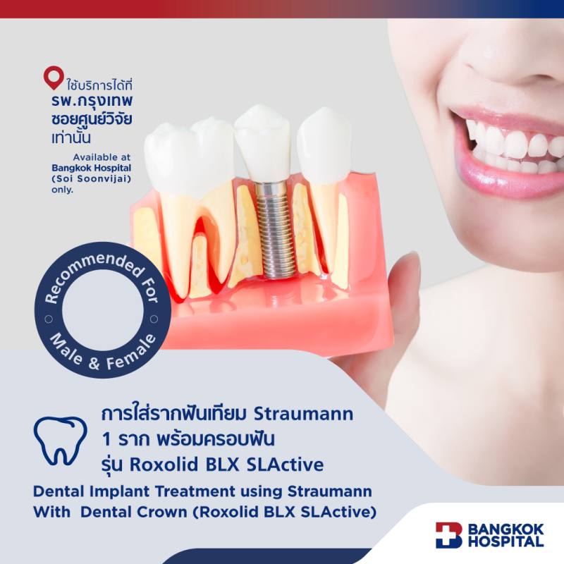 การใส่รากฟันเทียม Straumann 1 ราก พร้อมครอบฟัน รุ่น Roxolid BLX ...